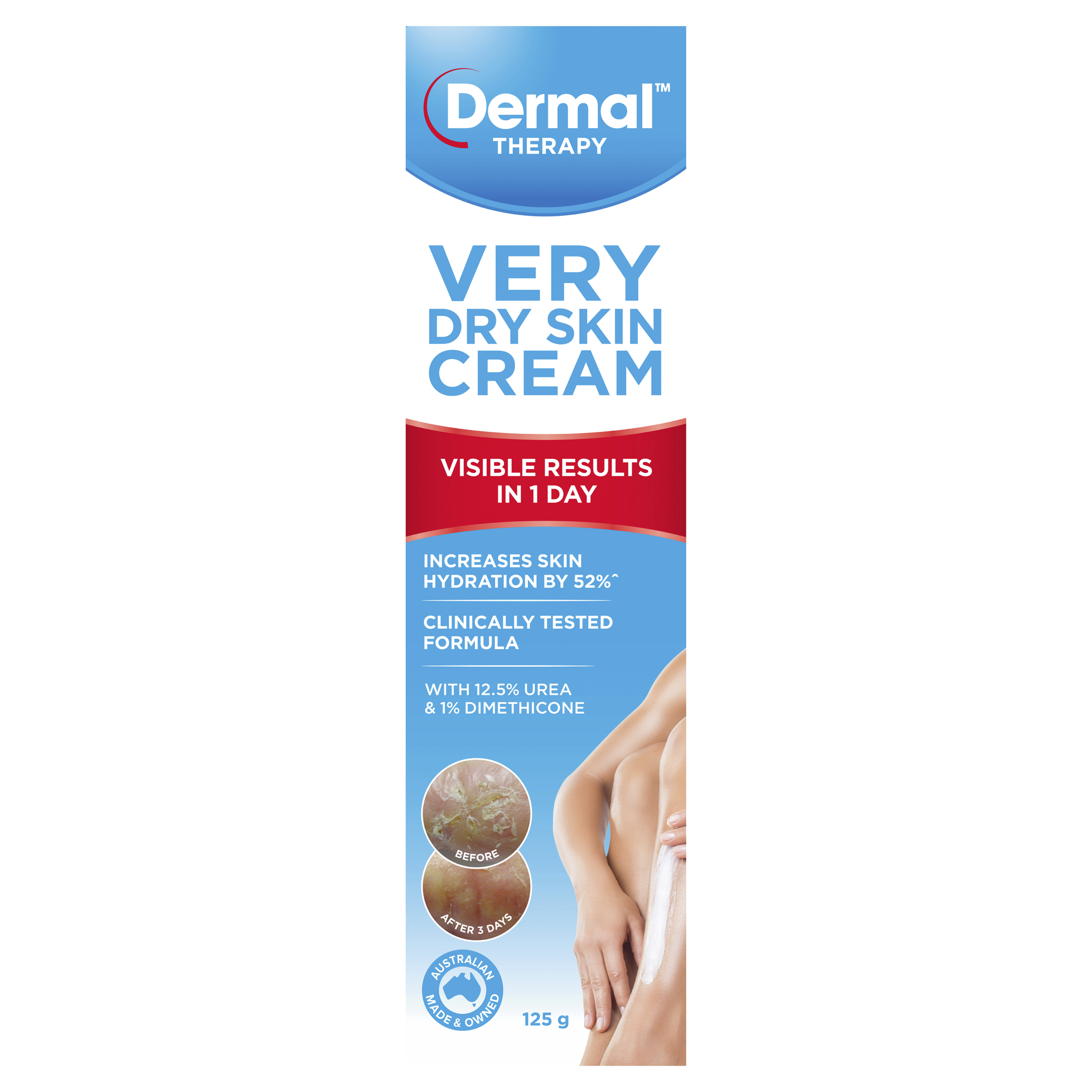 Dermal Therapy Very Dry Skin Cream - Net Pharmacy