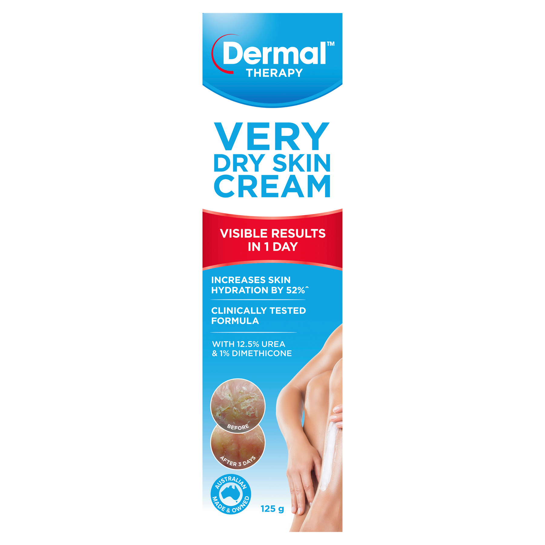 Dermal Therapy Very Dry Skin Cream - Net Pharmacy